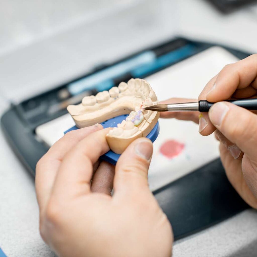 Protesi dentale fissa Roma